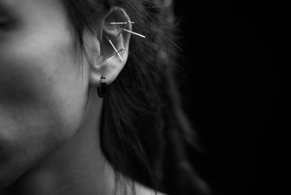 Acupuncture for Detoxification – Almeda Labs